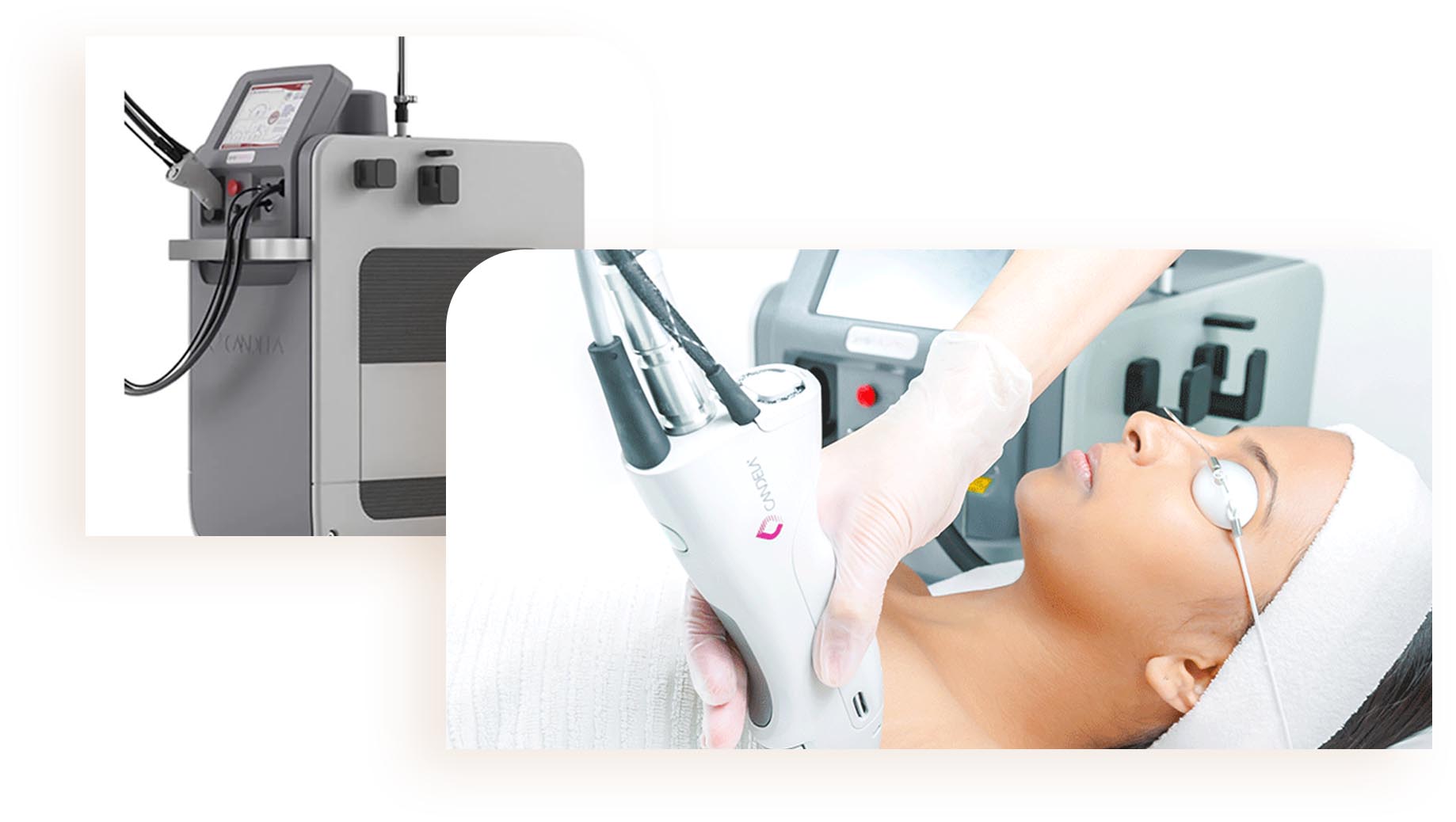 Laser ontharen - SA Laserclinic